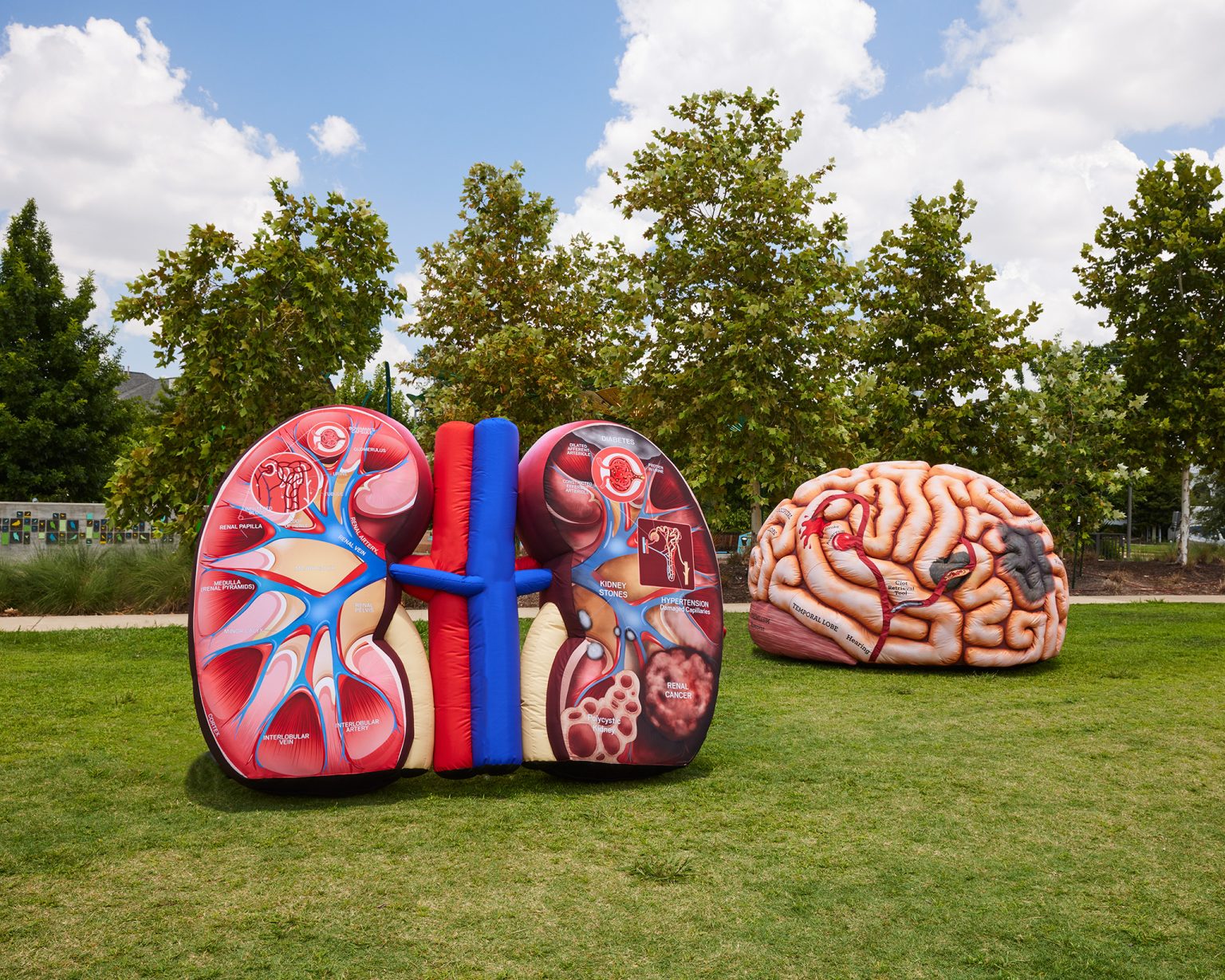 mega mini brain | Medical Inflatables