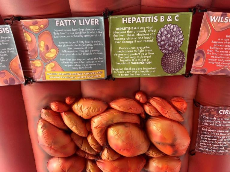 Health Fair Guide | Medical Inflatables