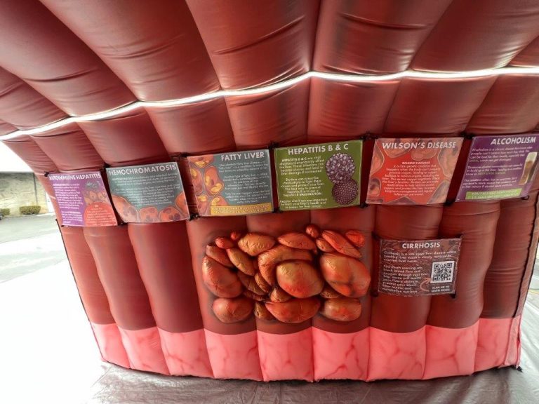 Health Fair Guide | Medical Inflatables