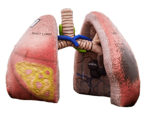 mega mini lungs | Medical Inflatables